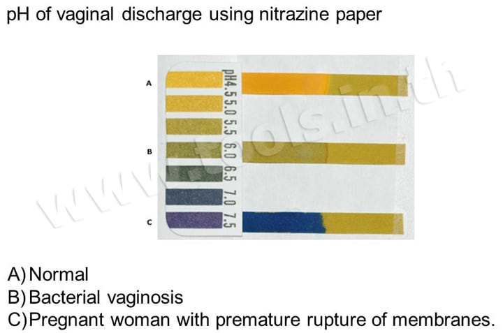 MN90711 กระดาษลิตมัสวัดค่า pH ทางการแพทย์ Nitrazine yellow paper